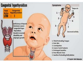 Congenital hypothyroidism | PPTX