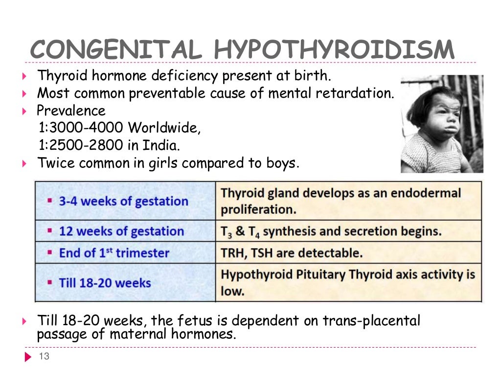 Congenital hypothyroidism