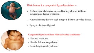 Congenital Hypothyroidism Adults