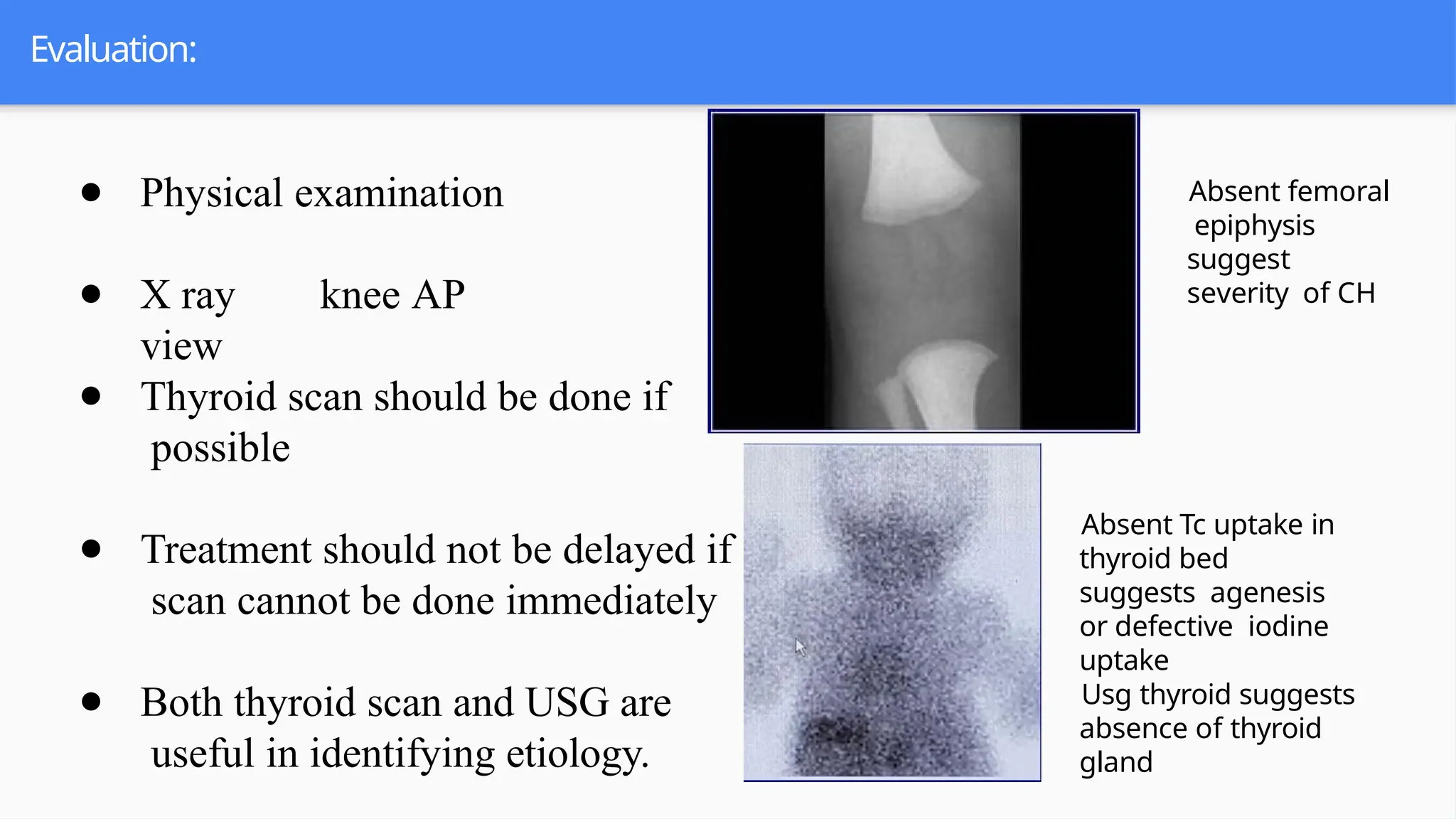 Congenital hypothyroidism in neonates.pptx