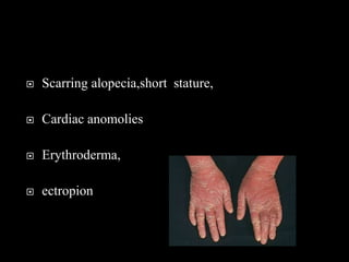 Congenital Ichthyosis Erythroderma