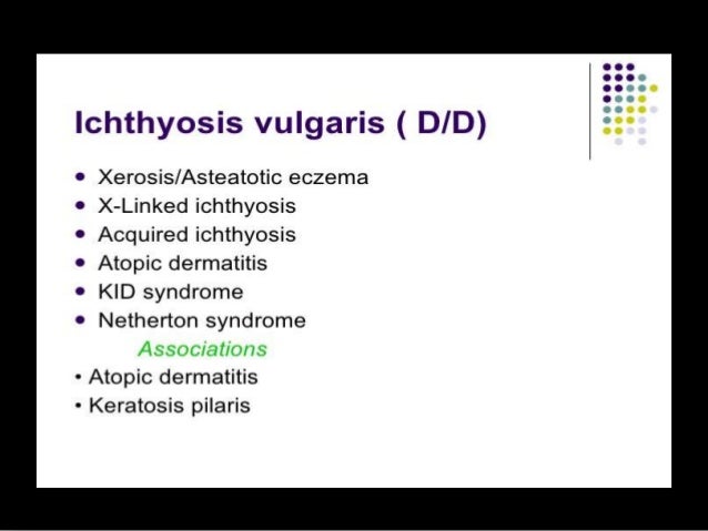 Congenital Ichthyosis