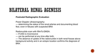Congenital Kidney Anomalies * ANOMALIES OF RENAL NUMBER * ANOMALIES OF ...