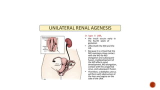 Congenital Kidney Anomalies * ANOMALIES OF RENAL NUMBER * ANOMALIES OF ...