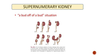 Congenital Kidney Anomalies * ANOMALIES OF RENAL NUMBER * ANOMALIES OF ...