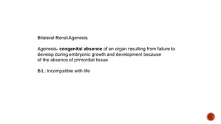 Congenital Kidney Anomalies * ANOMALIES OF RENAL NUMBER * ANOMALIES OF ...