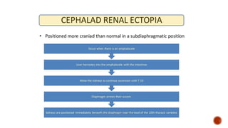Congenital Kidney Anomalies * ANOMALIES OF RENAL NUMBER * ANOMALIES OF ...
