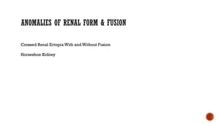 Congenital Kidney Anomalies * ANOMALIES OF RENAL NUMBER * ANOMALIES OF ...