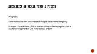 Congenital Kidney Anomalies * ANOMALIES OF RENAL NUMBER * ANOMALIES OF ...