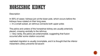 Congenital Kidney Anomalies * ANOMALIES OF RENAL NUMBER * ANOMALIES OF ...