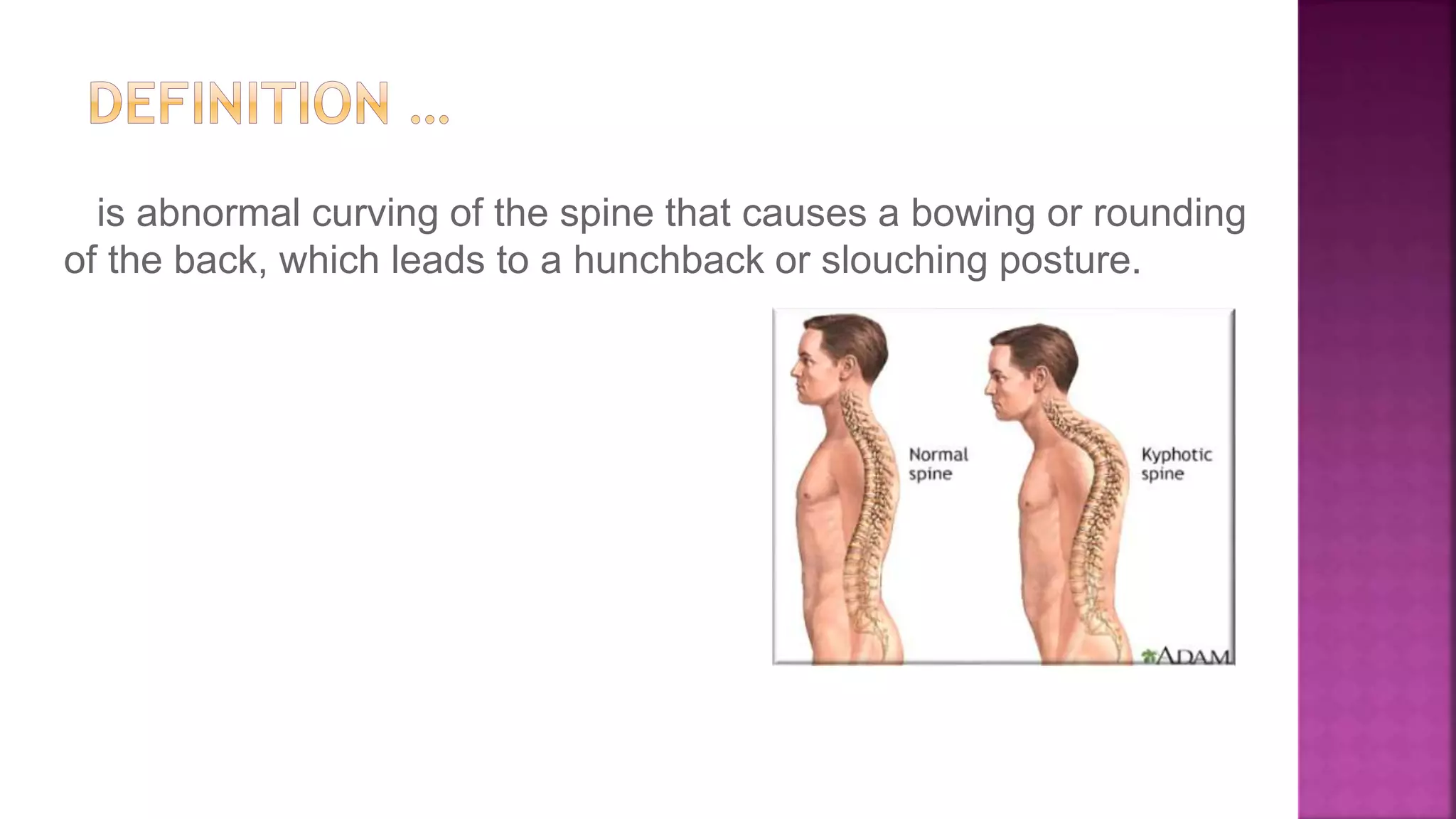 Congenital kyphosis | PPTX