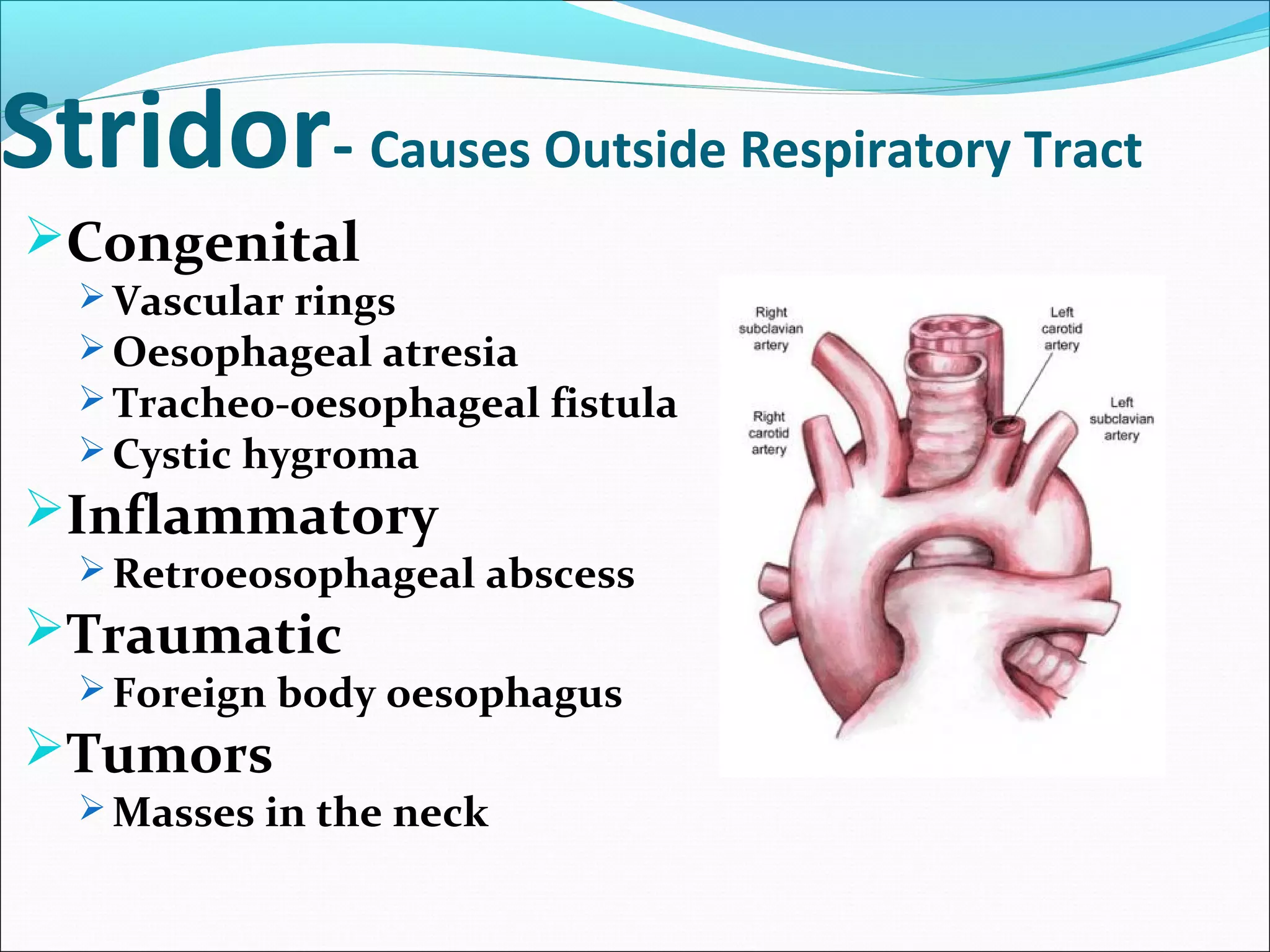 Congenital lesions of larynx and Stridor in Neonates | PPT