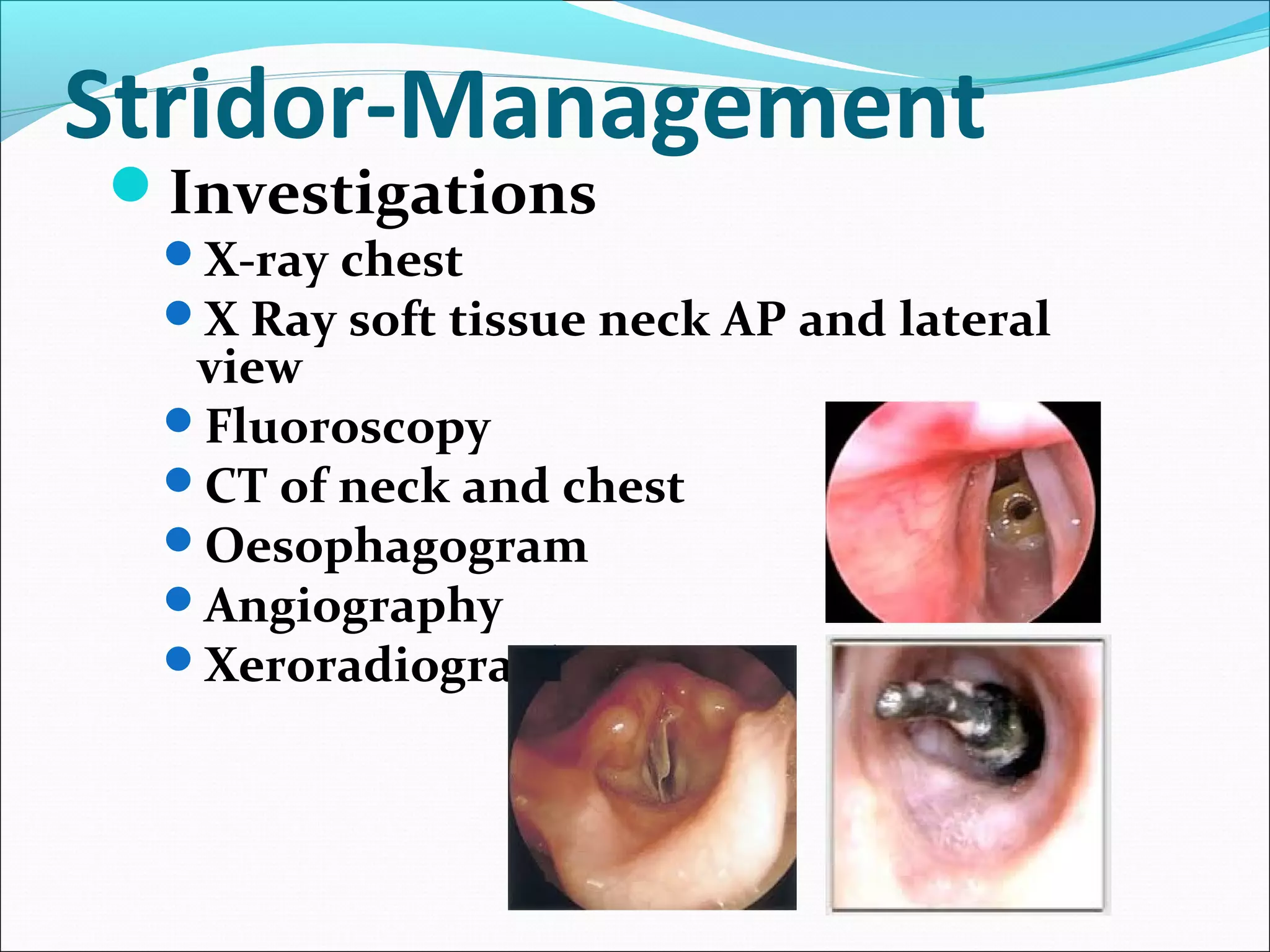 Congenital lesions of larynx and Stridor in Neonates | PPT