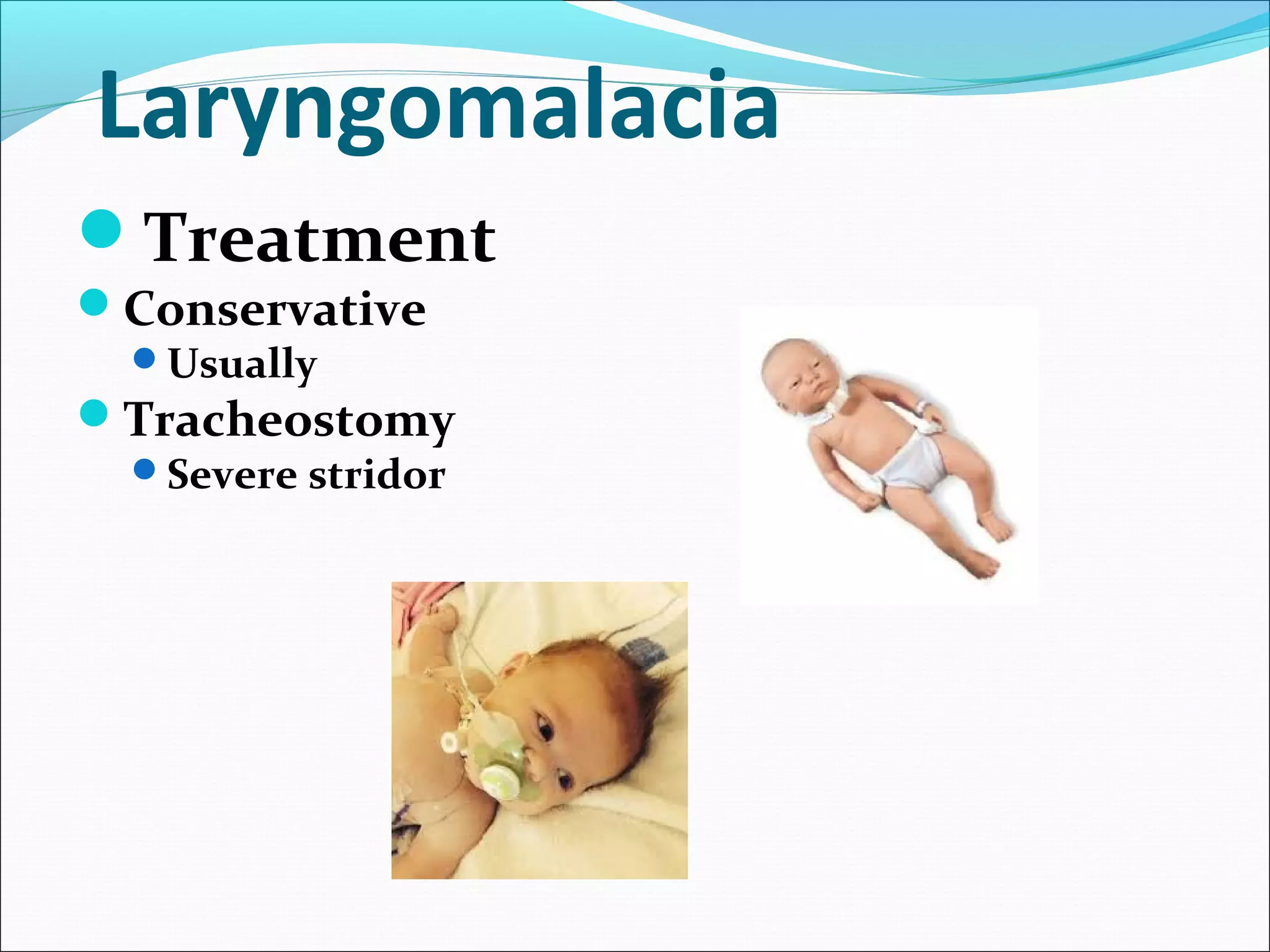 Congenital lesions of larynx and Stridor in Neonates | PPT