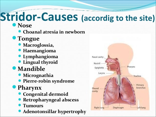 Congenital lesions of larynx and Stridor in Neonates