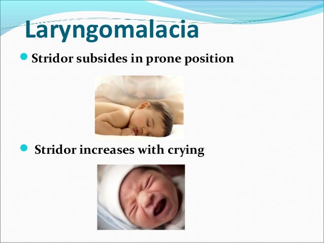 Congenital lesions of larynx and Stridor in Neonates