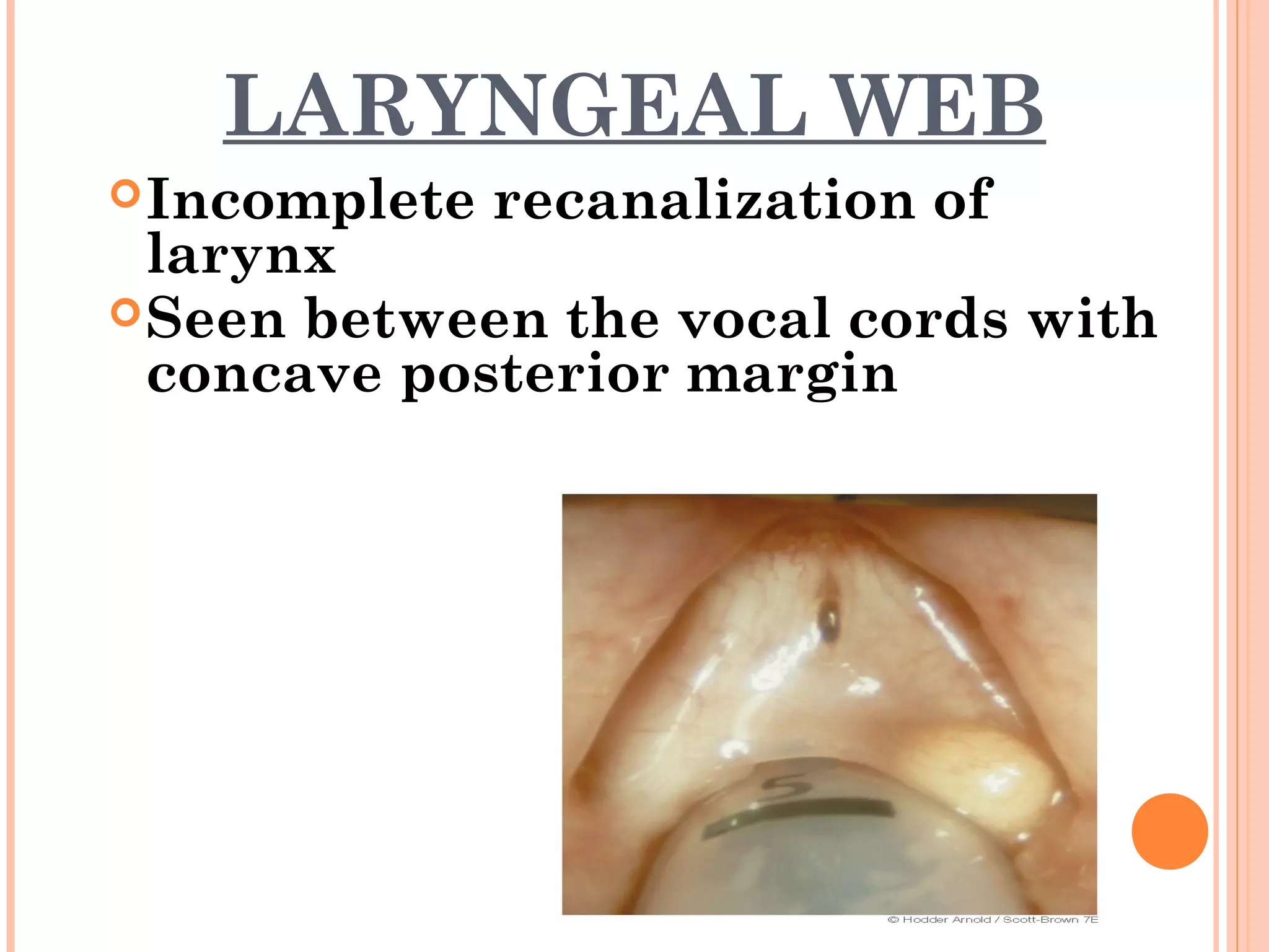 Congenital lesions of larynx and stridor management | PPT
