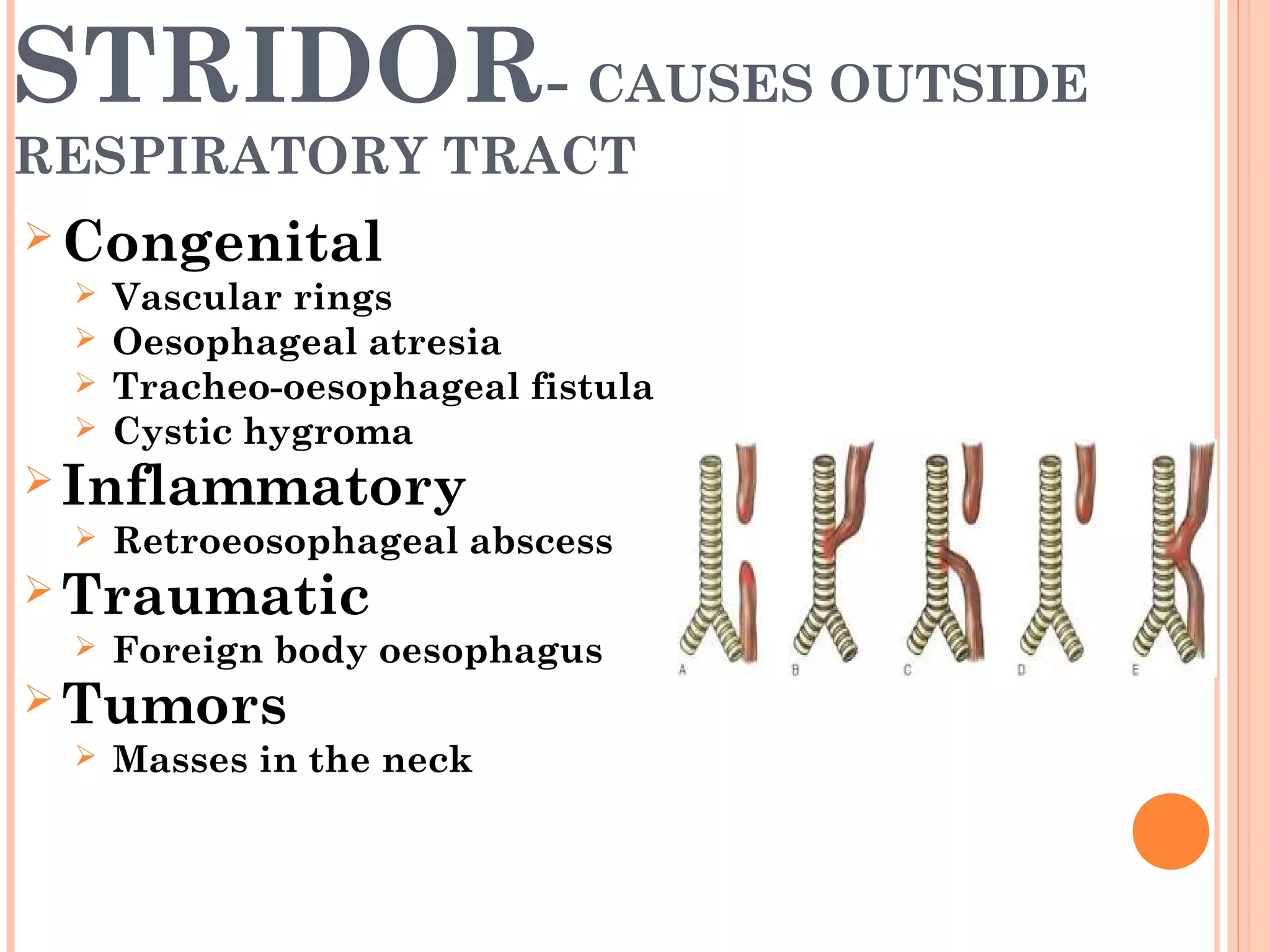 Congenital lesions of larynx and stridor management | PPT