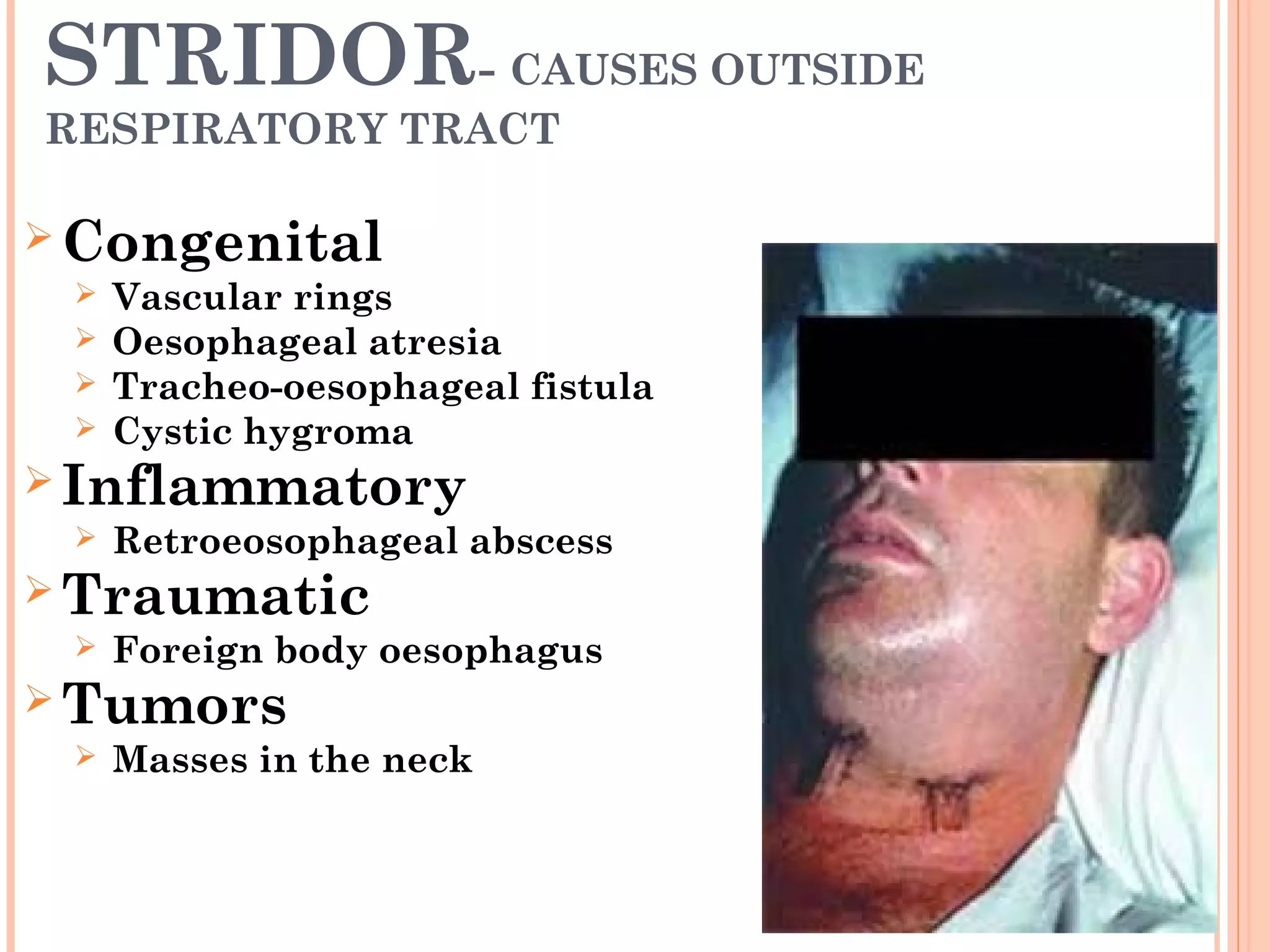 Congenital lesions of larynx and stridor management | PPT