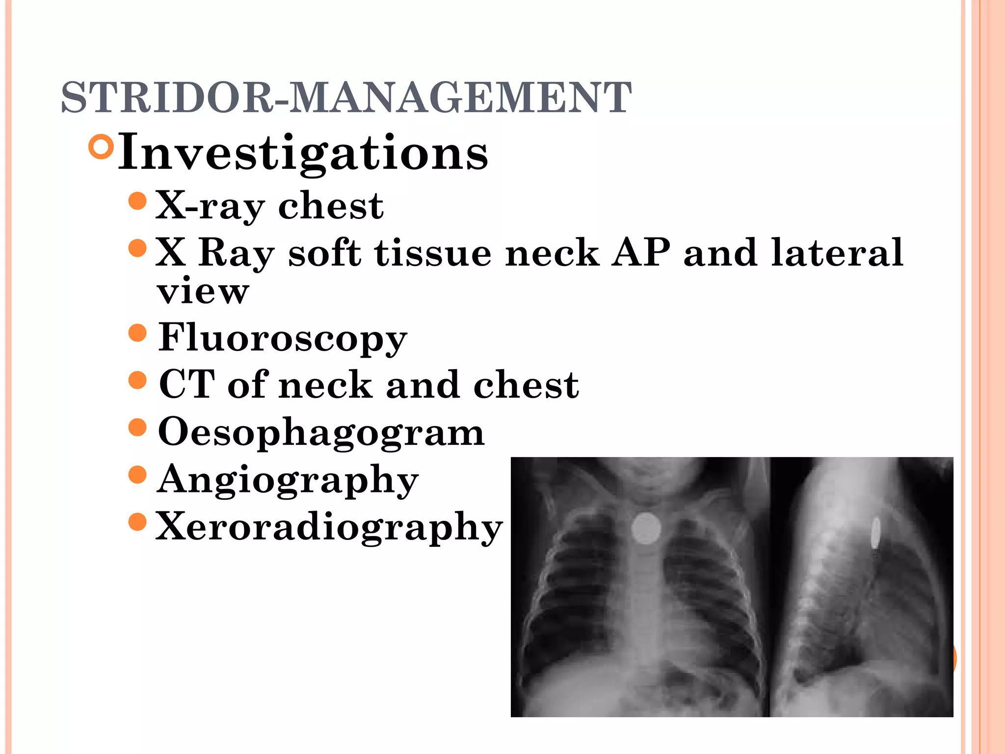 Congenital lesions of larynx and stridor management | PPT