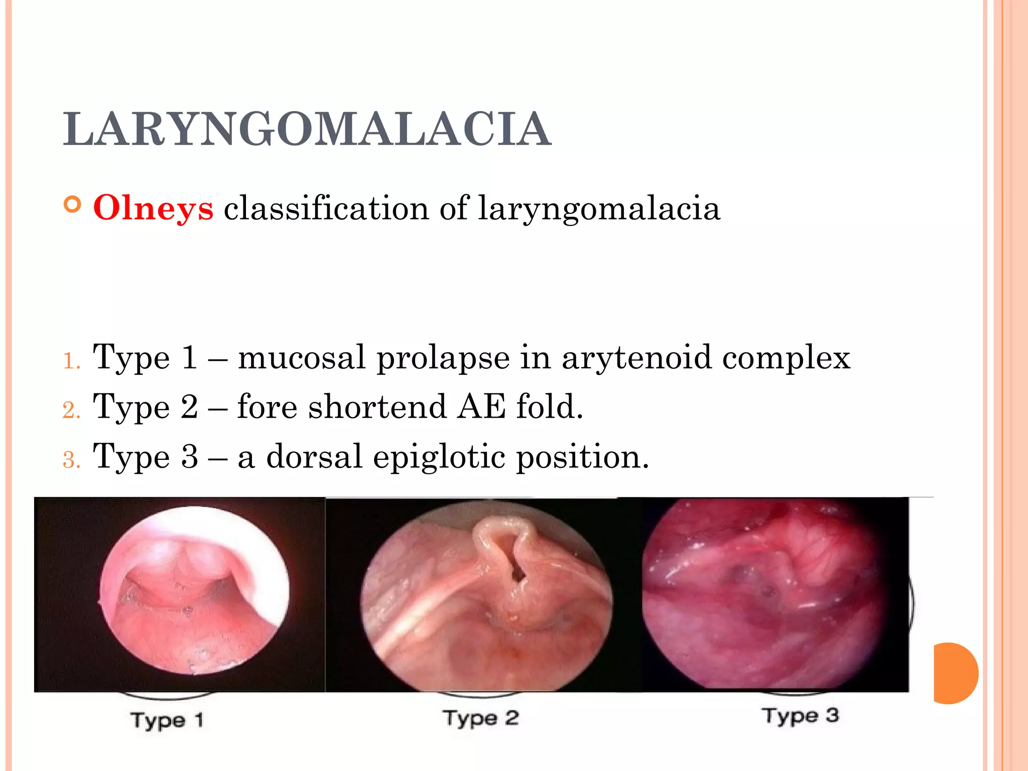 Congenital lesions of larynx and stridor management | PPT