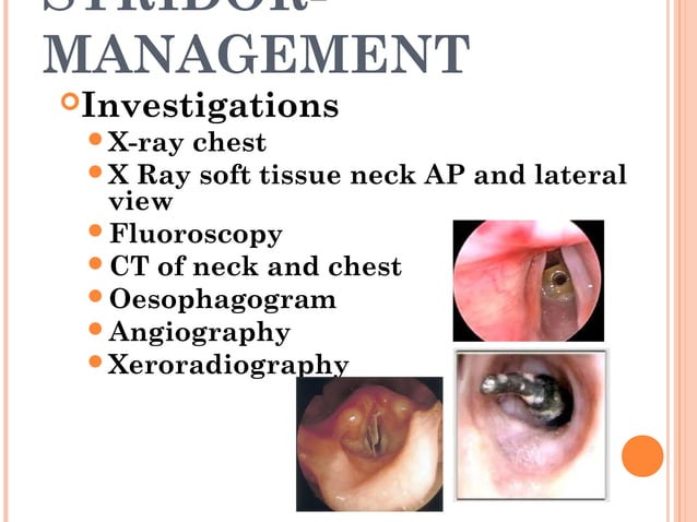 Congenital lesions of larynx and stridor management | PPT