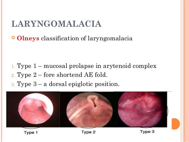 Congenital lesions of larynx and stridor management