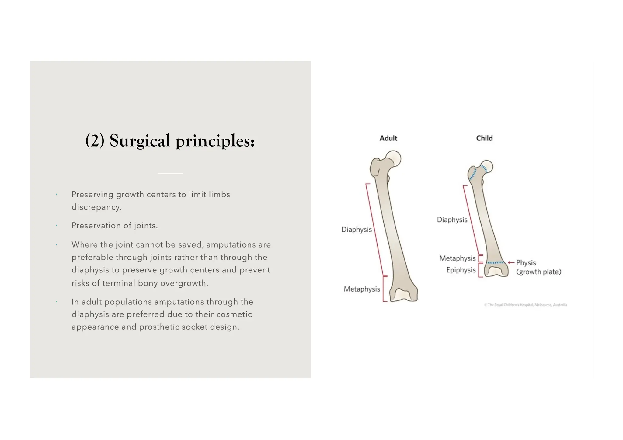 Congenital Limb deficiencies. Physiotherapy for pediatrics.pdf
