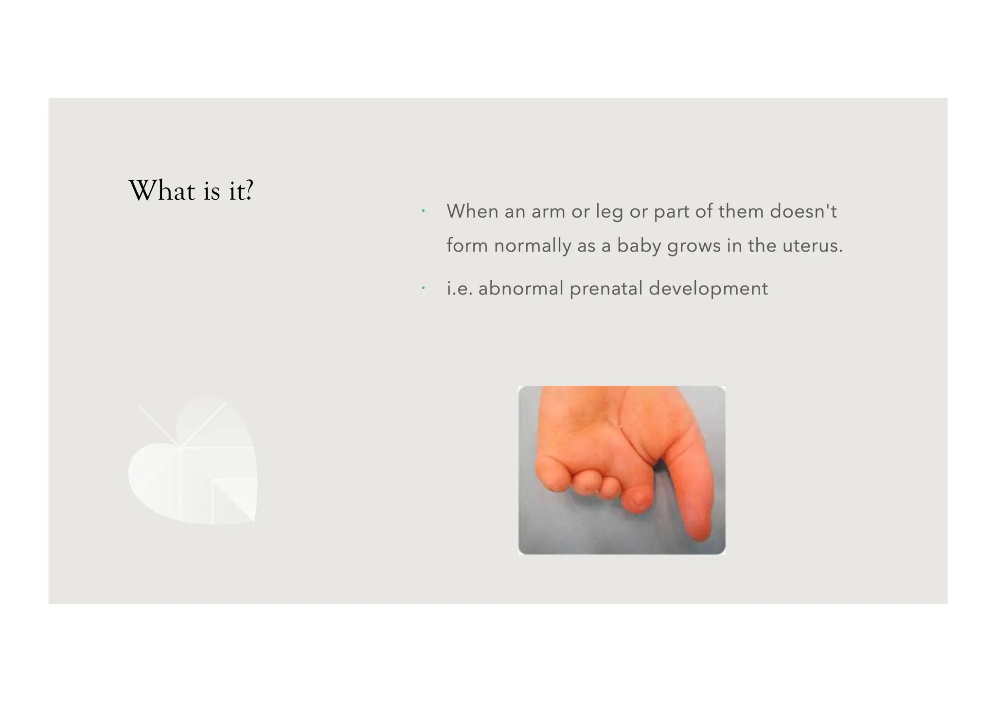 Congenital Limb deficiencies. Physiotherapy for pediatrics.pdf