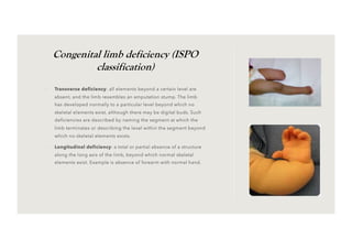 Congenital Limb deficiencies. Physiotherapy for pediatrics.pdf