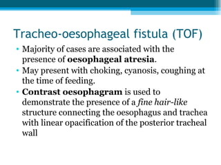 Congenital lung abnormalities | PPT