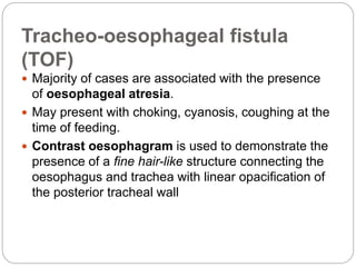 Congenital lung diseases | PPTX
