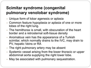 Congenital lung diseases | PPTX
