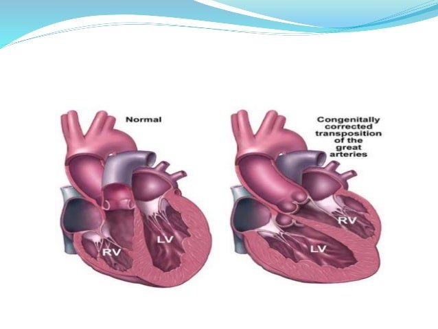Congenitally