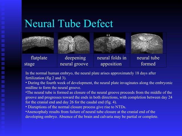 Congenital malformation of cns | PPT