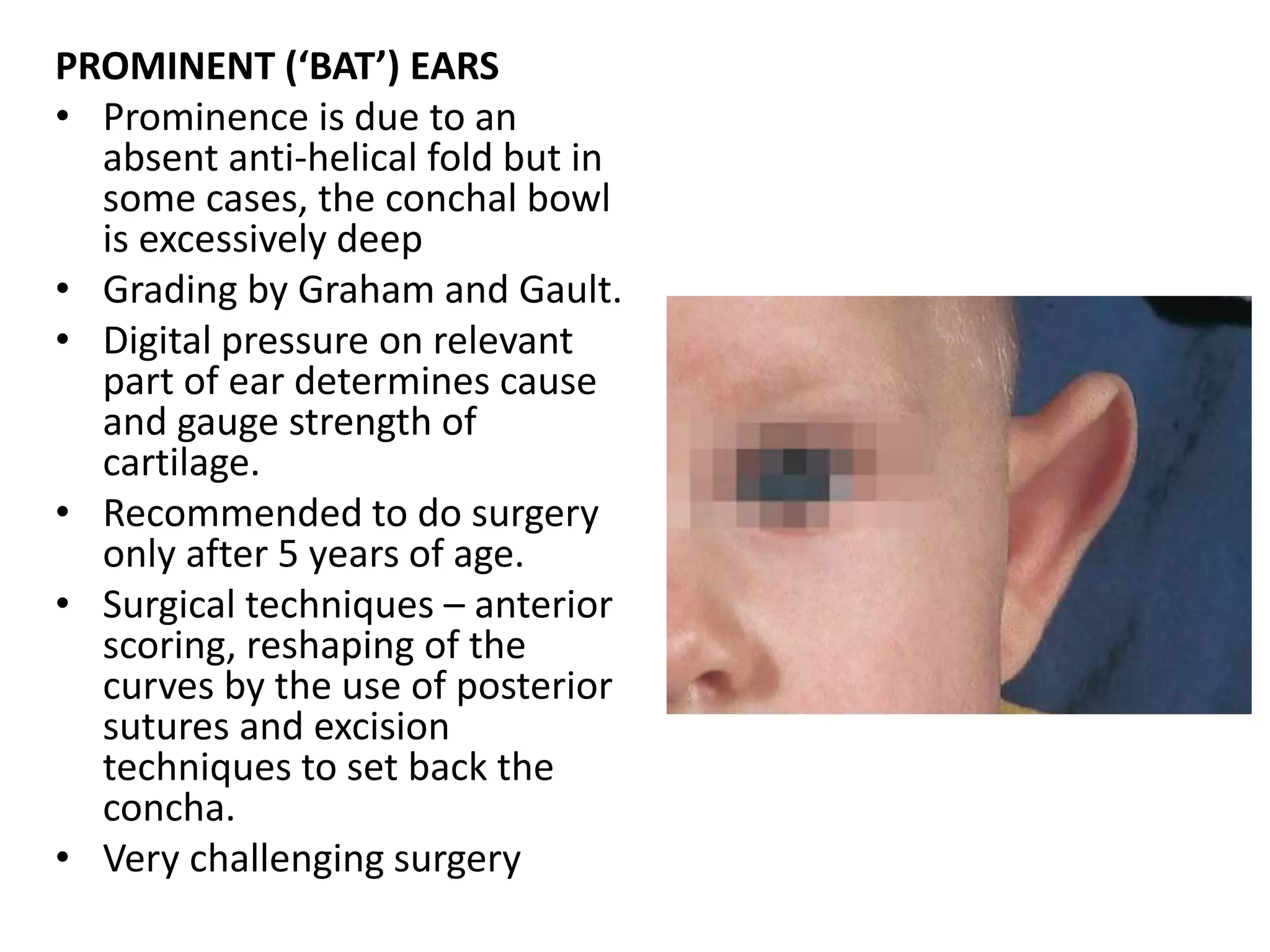 Congenital malformation of external ear and it’s management | PPTX