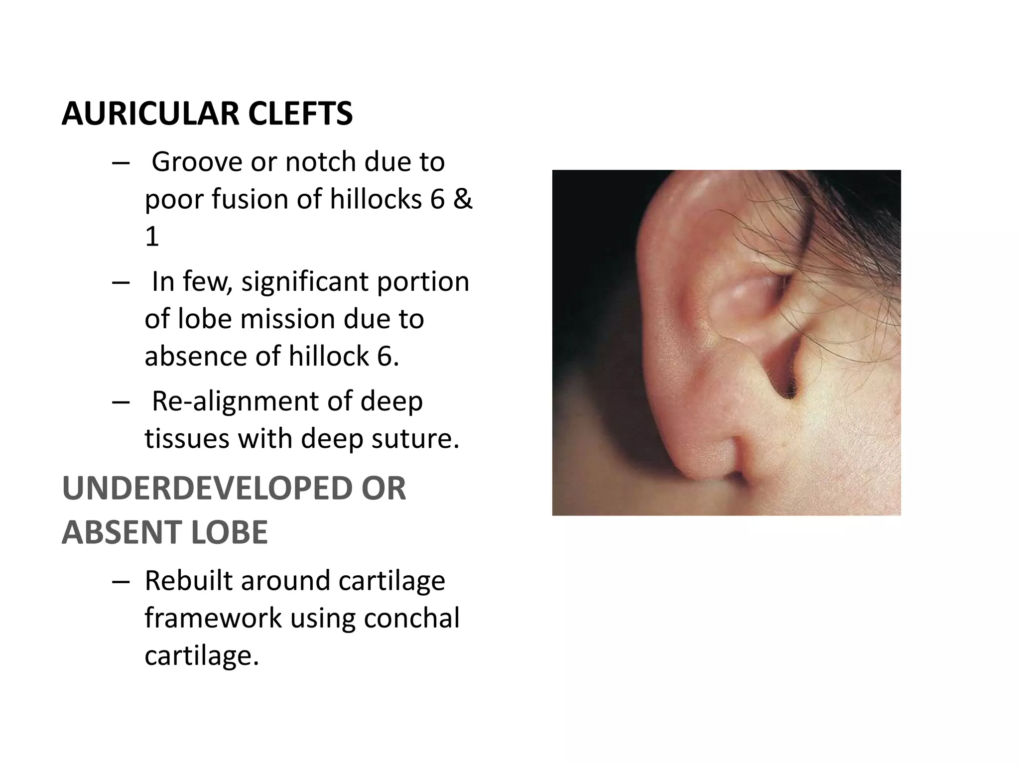 Congenital malformation of external ear and it’s management | PPTX