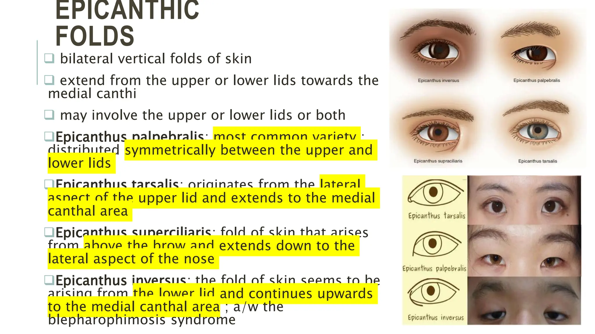 CONGENITAL MALFORMATIONS OF EYELIDS.pptx