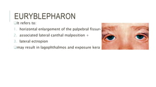 CONGENITAL MALFORMATIONS OF EYELIDS.pptx | Ear, Nose and Throat ...
