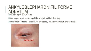 CONGENITAL MALFORMATIONS OF EYELIDS.pptx