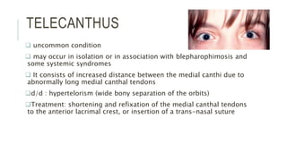CONGENITAL MALFORMATIONS OF EYELIDS.pptx | Ear, Nose and Throat ...