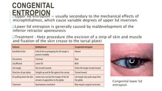 CONGENITAL MALFORMATIONS OF EYELIDS.pptx