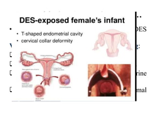 Congenital malformation of female reproductive organ | PPTX