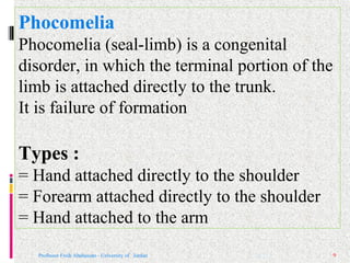 العيوب الخلقيه في اليدين عند الاطفال - Congenital malformation of the ...