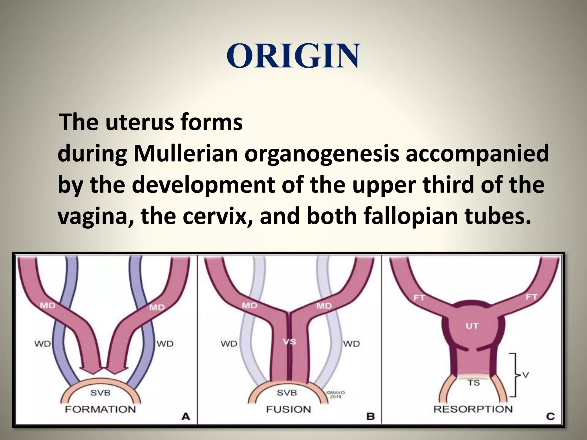 CONGENITAL MALFORMATION OF UTERUS AND VAGINA 2.pptx