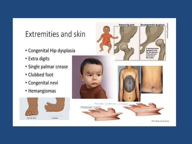 UNIT-5: CONGENITAL MALFORMATION IN PAEDIATRIC | PPTX | Eye and Vision ...