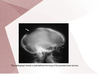 Congenital malformations of brain | PPT