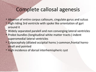 Congenital malformations of brain | PPT