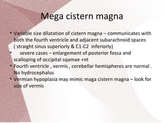 Congenital malformations of brain | PPT