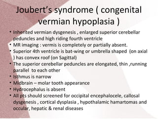 Congenital malformations of brain | PPT